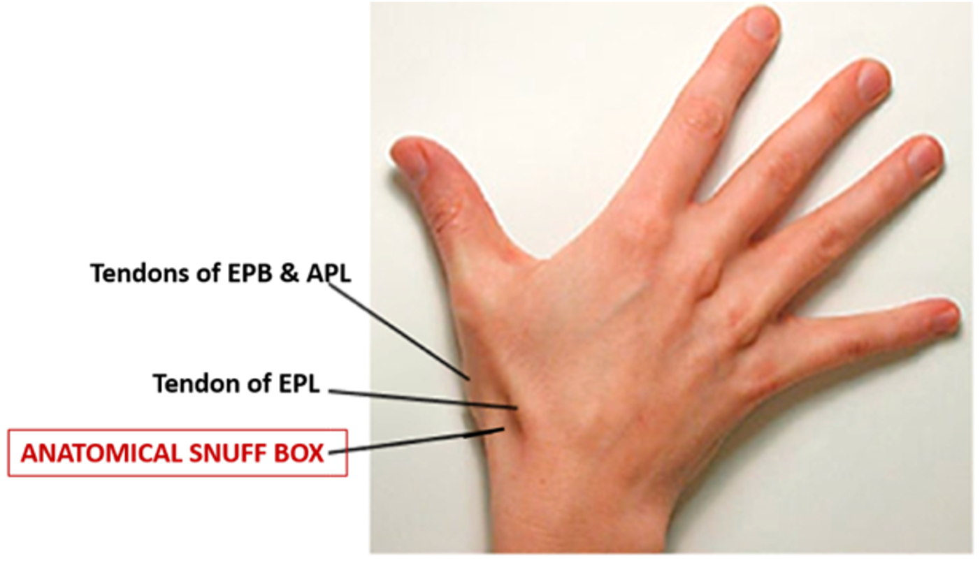 Common Wrist Injuries – Purpose Physiotherapy